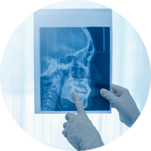 TMJ Treatment | Williamsport, PA | Susquehanna OMFS